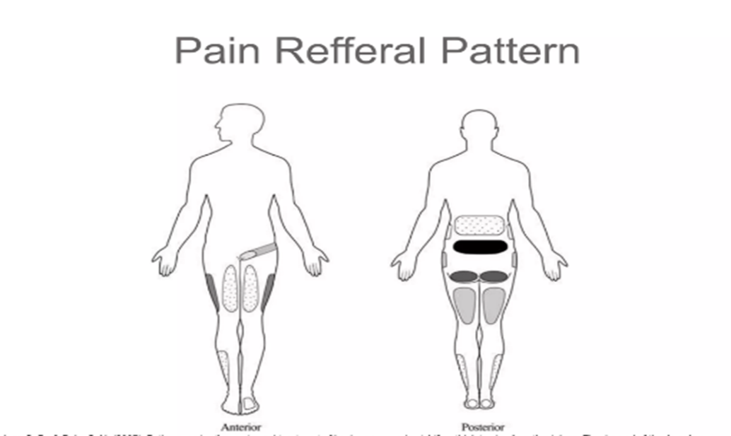 Facet Arthritis - Dr. Mahmood Ahmad
