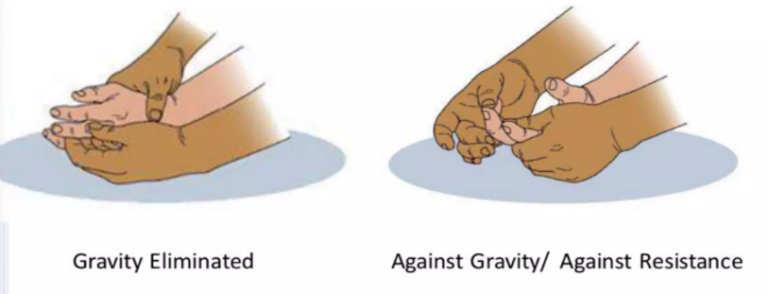 Asia (American Spinal Injury Association) Chart - Dr Mahmood