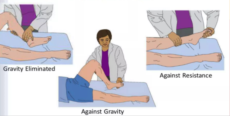 Asia (American Spinal Injury Association) Chart - Dr Mahmood