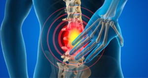 Effect of Smoking on Spine Health - Dr. Mahmood Ahmad