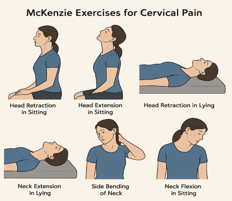 Physical Therapy for Cervical Radiculopathy - Dr. Mahmood